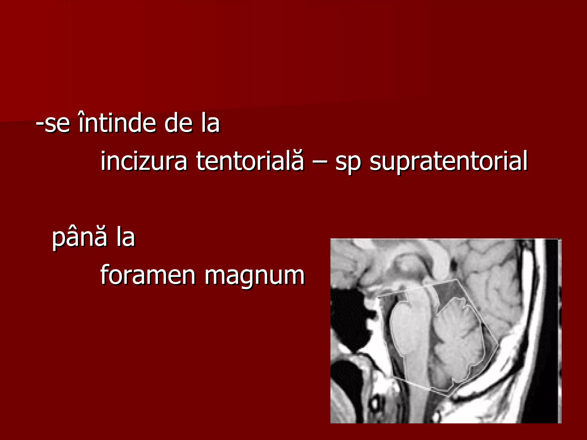 Anatomia cerebelului | PPT