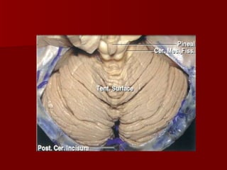 Anatomia cerebelului | PPT