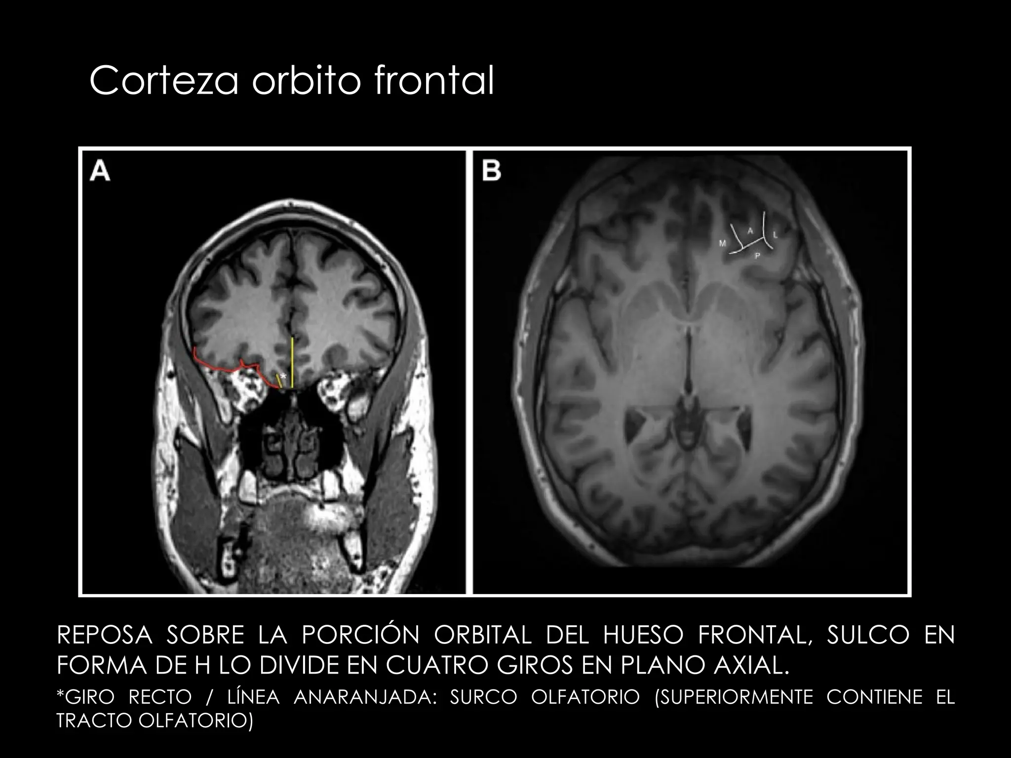 ANATOMIA CEREBRAL HEMISFERIOS Y CIRCUNVOLUCIONES R2. AYALA.pptx
