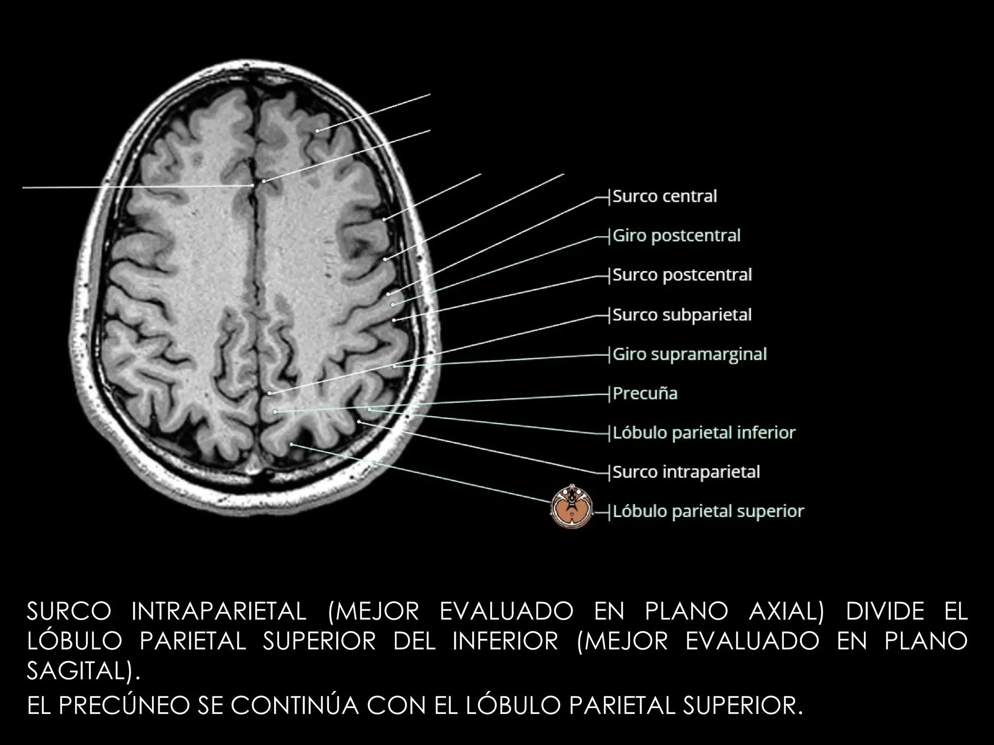 ANATOMIA CEREBRAL HEMISFERIOS Y CIRCUNVOLUCIONES R2. AYALA.pptx