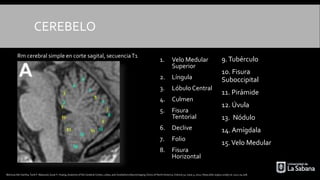 Anatomía cerebro.pptx