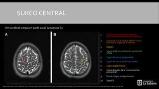 Anatomía cerebro.pptx