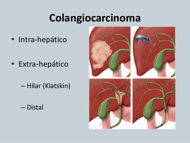 Anatomia clínico cirúrgica de pâncreas e vias biliares