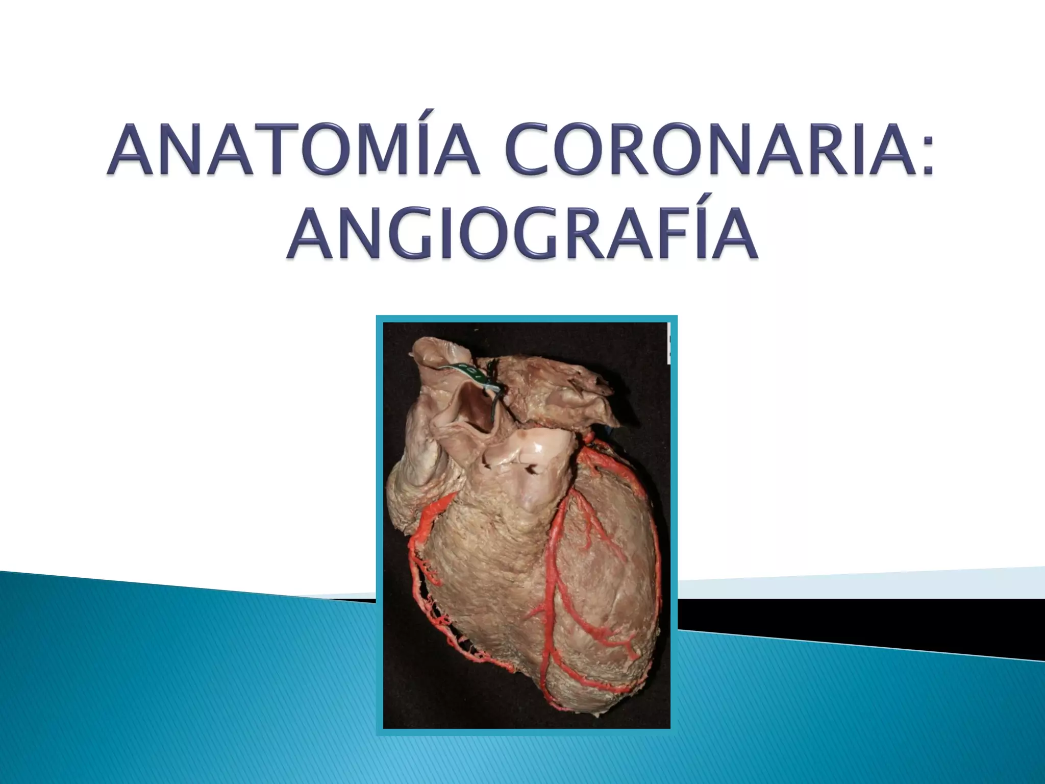 Anatomía coronaria básica - Coronariografía. Visualización de las ...