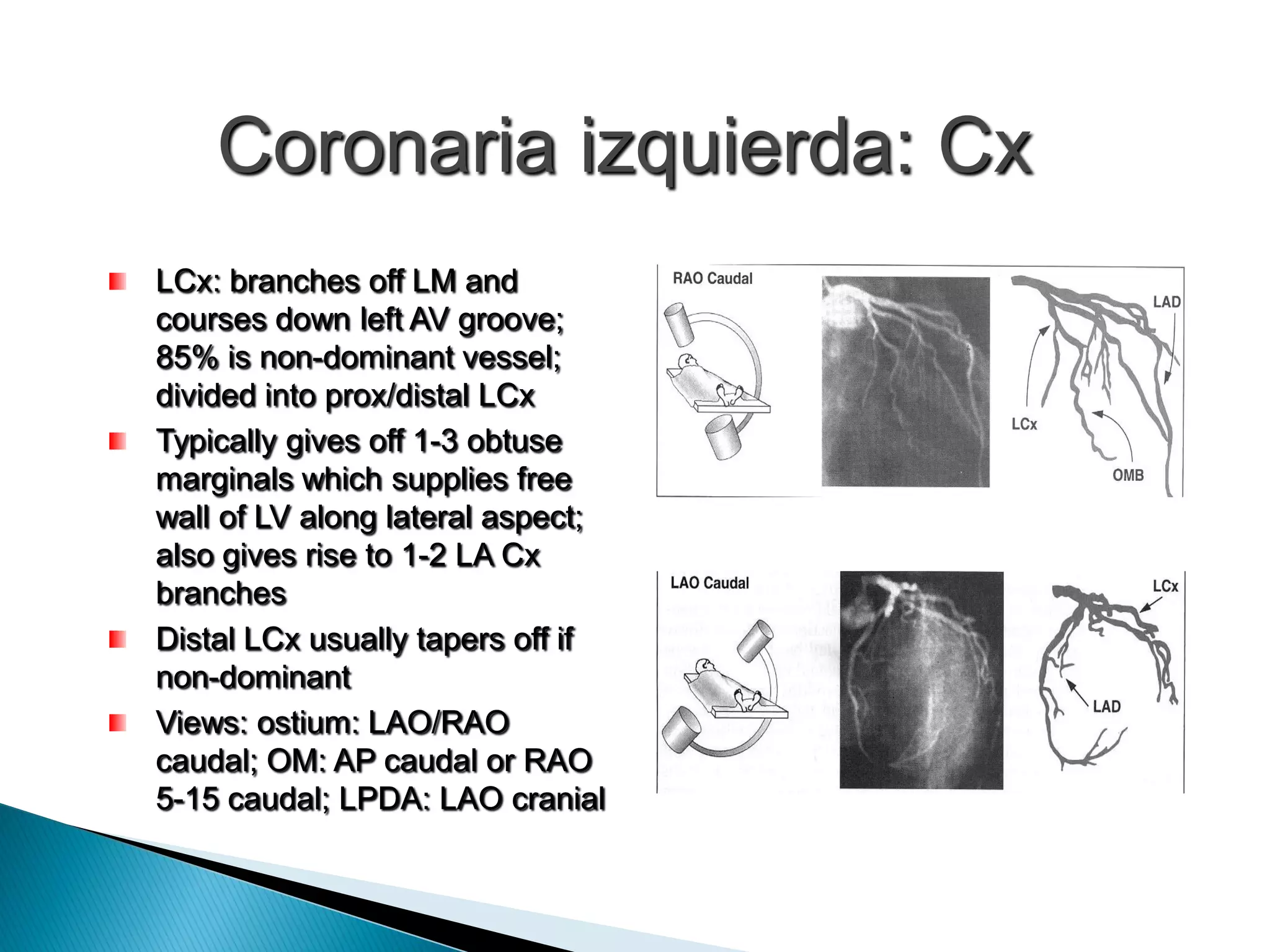Anatomía coronaria básica - Coronariografía. Visualización de las ...