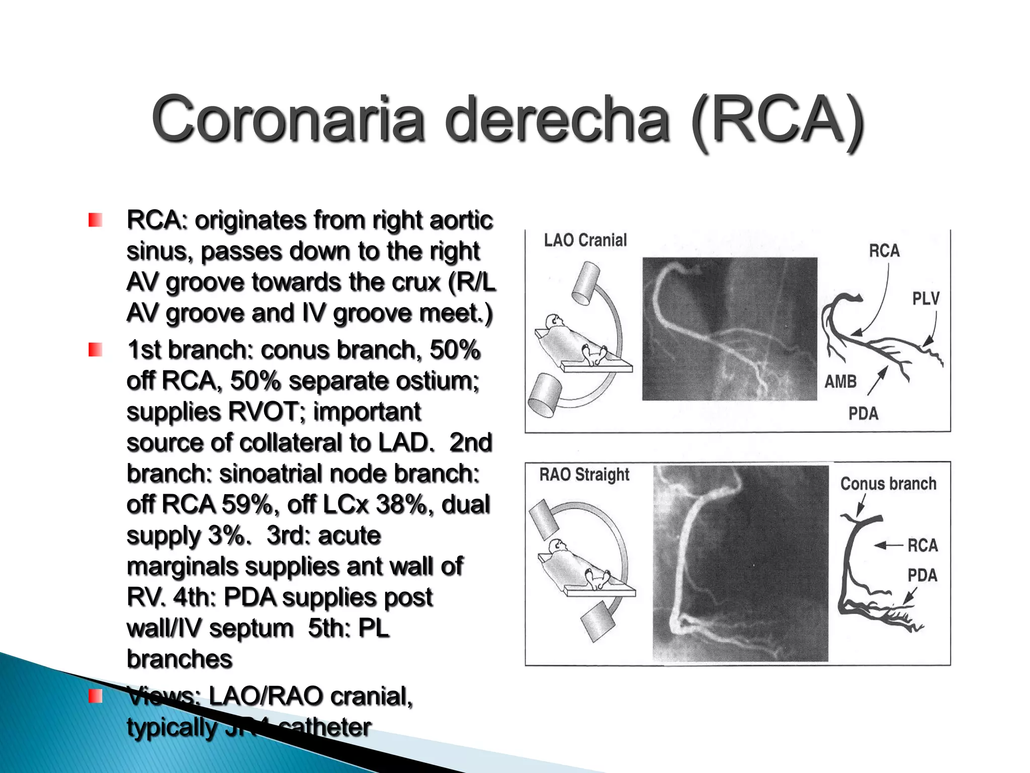 Anatomía coronaria básica - Coronariografía. Visualización de las ...