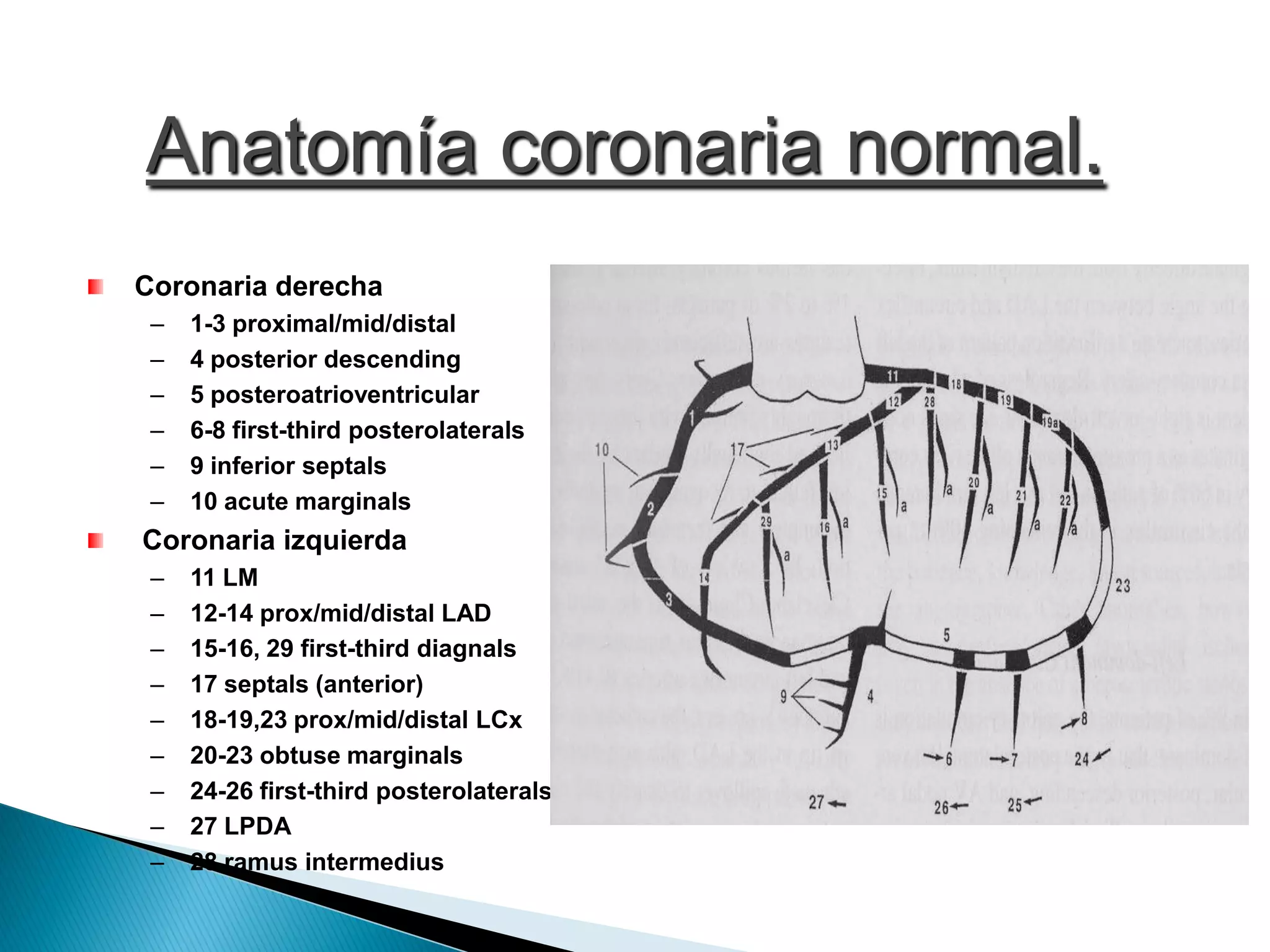 Anatomía coronaria básica - Coronariografía. Visualización de las ...