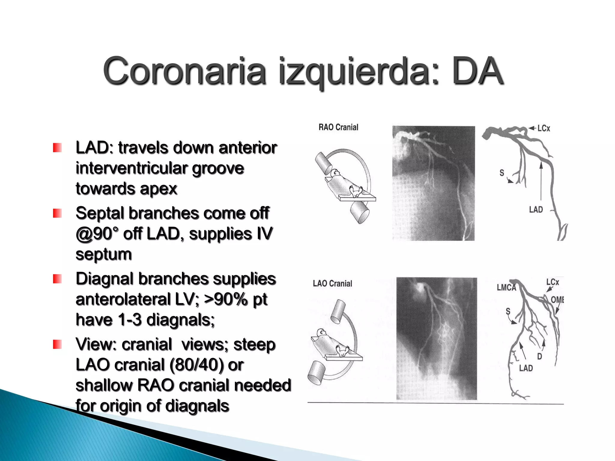 Anatomía coronaria básica - Coronariografía. Visualización de las ...
