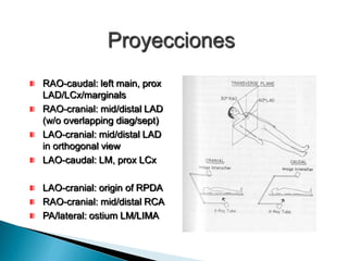 Anatomia coronaria basica | PDF