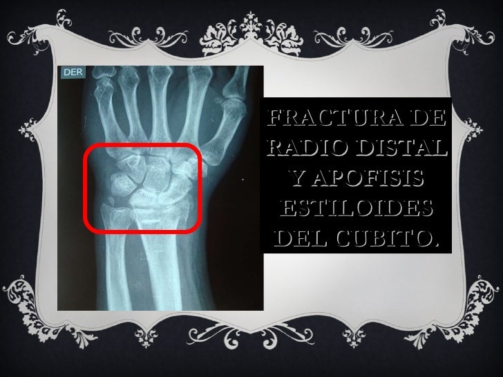 Anatomia cuerpo humanao