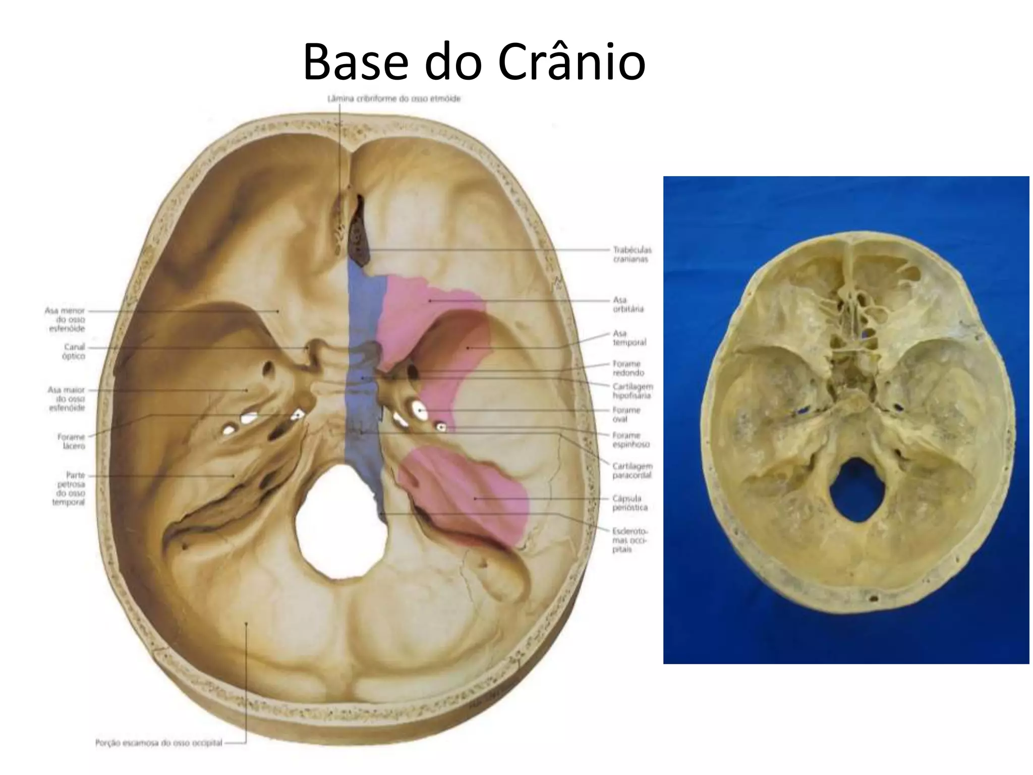 ANATOMIA DA CABEÇA AULA 1 Introdução e ossos do crânio.pptx