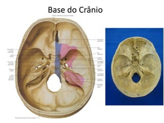 ANATOMIA DA CABEÇA AULA 1 Introdução e ossos do crânio.pptx