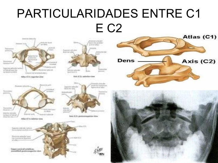 Anatomia da coluna cervical