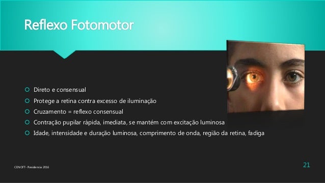 Anatomia da iris e corpo ciliar