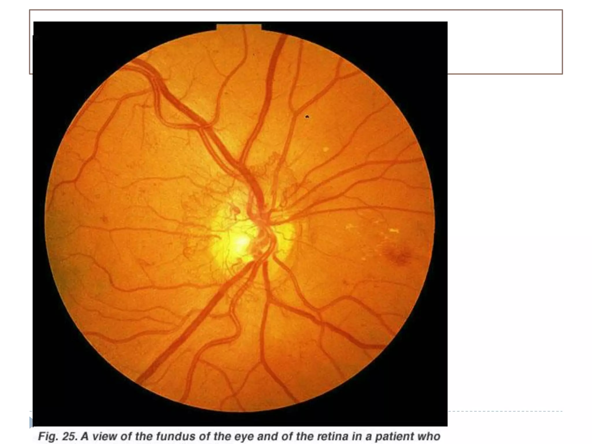 Anatomia da retina e vítreo | PDF
