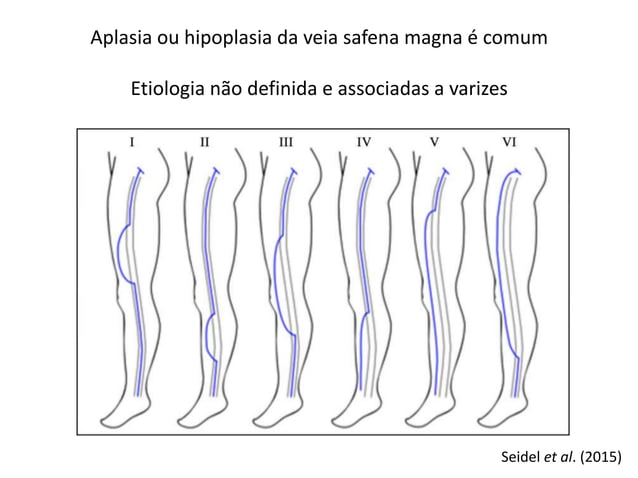 Anatomia da veia safena magna