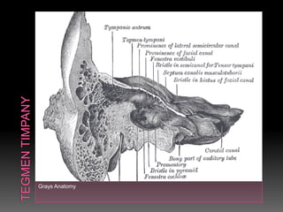 ANATOMIA DE CAJA TIMPANICA.ppt
