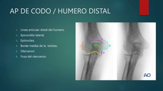 Anatomia de Codo.pptx