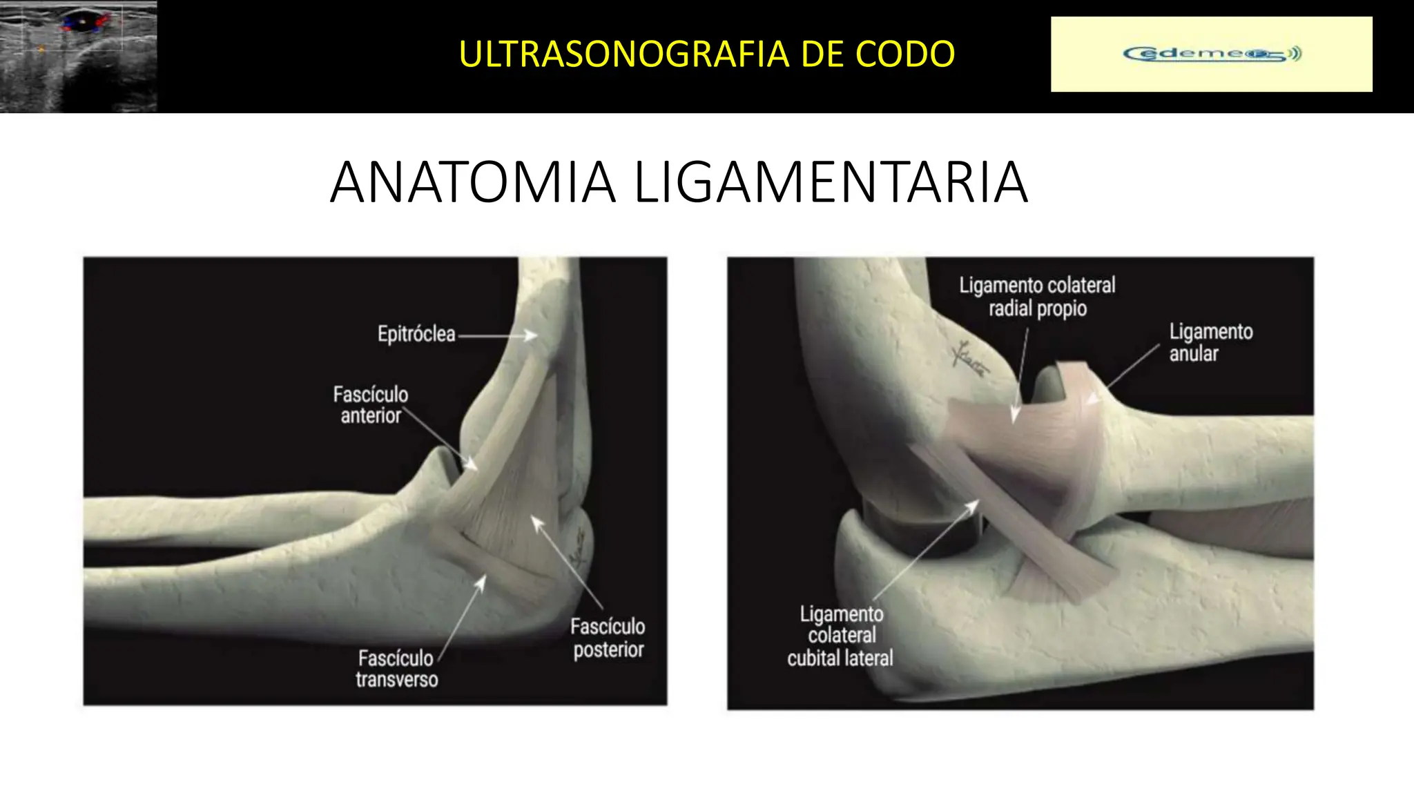 Anatomía De La Estructura Del Codo