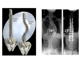 Anatomia+de+columna | PPTX