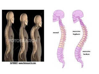 Anatomia+de+columna | PPTX