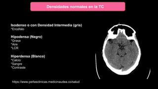 Anatomia de Craneo.pptx
