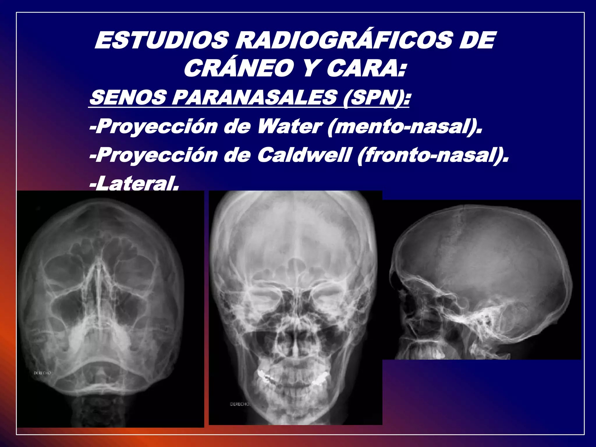 Anatomia de cranio y cara con diagnostico en rx | PDF