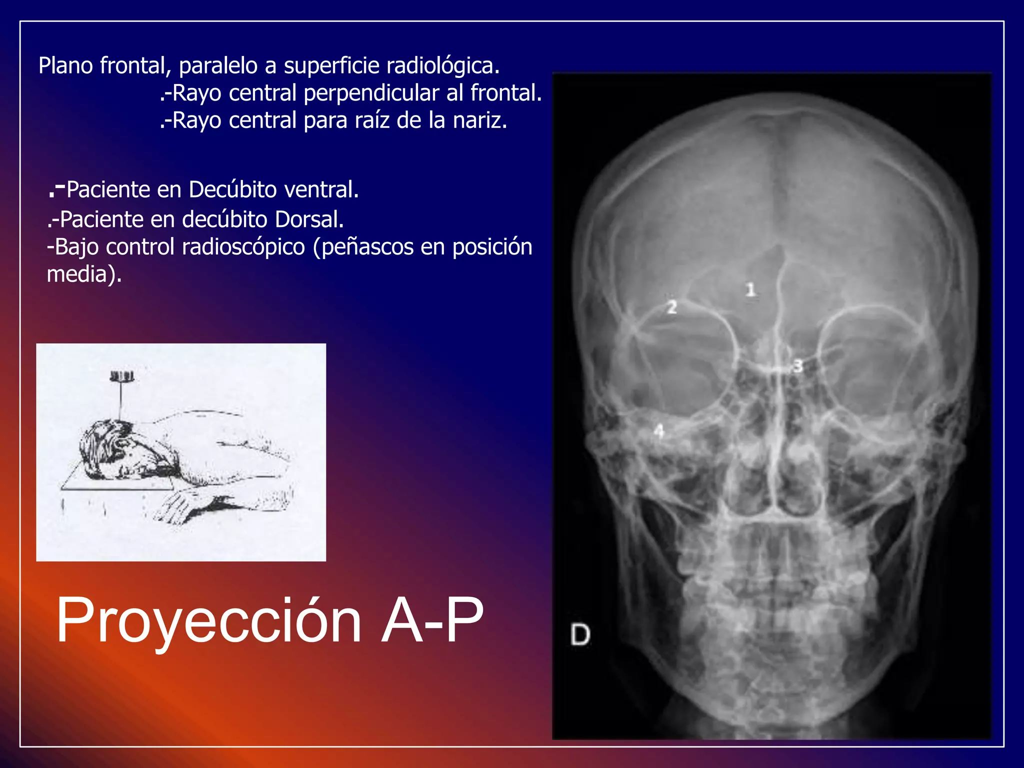 Anatomia de cranio y cara con diagnostico en rx | PDF