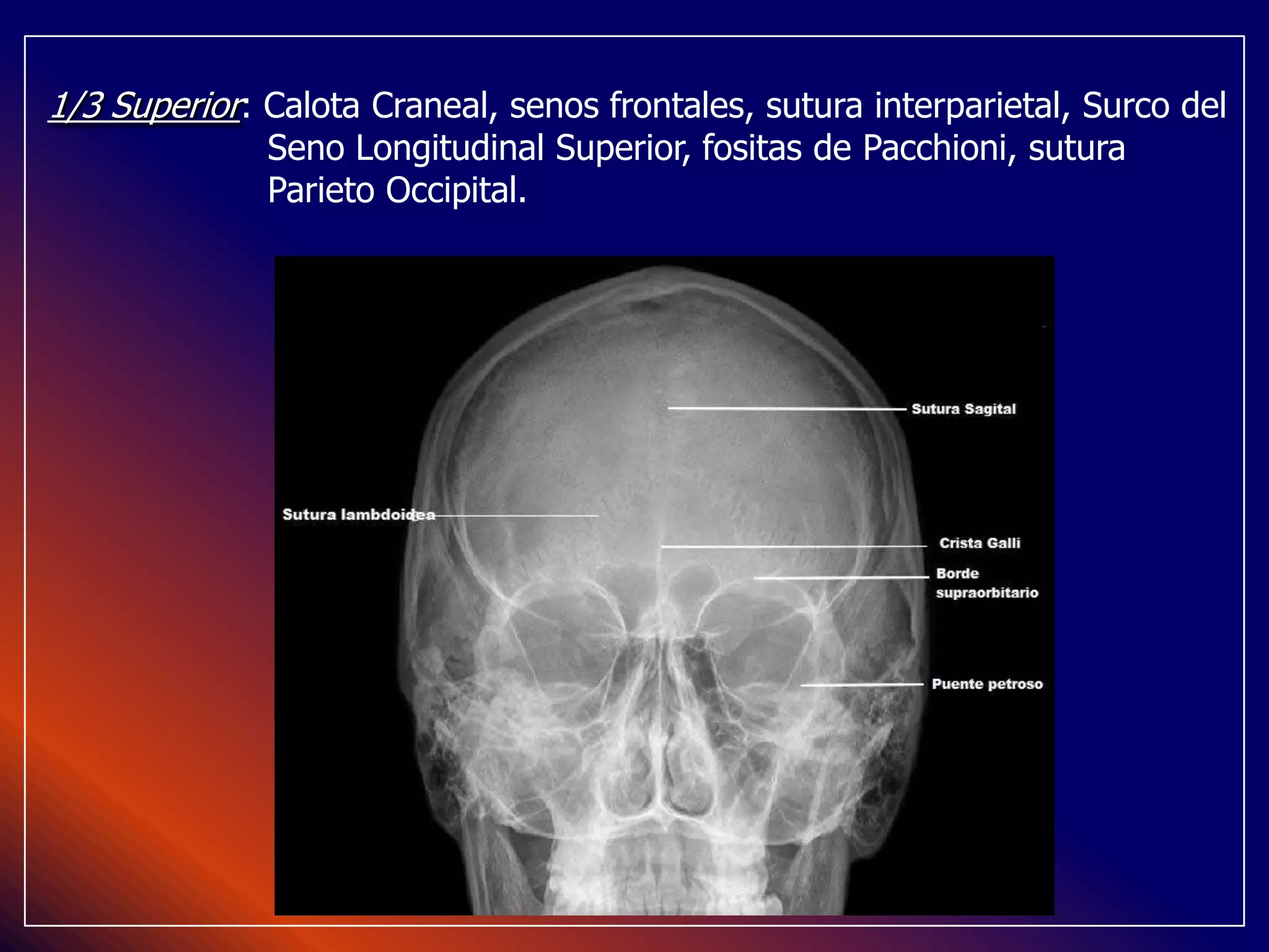 Anatomia de cranio y cara con diagnostico en rx | PDF
