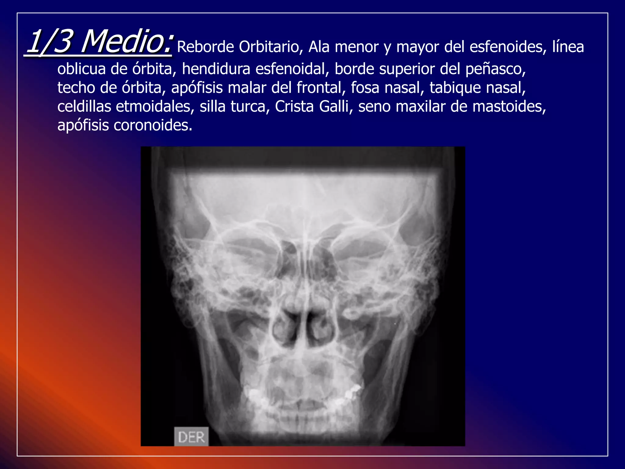 Anatomia de cranio y cara con diagnostico en rx | PDF