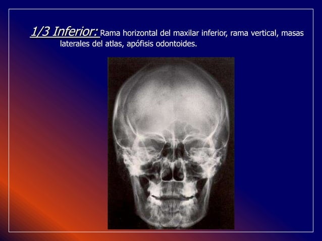 Anatomia de cranio y cara con diagnostico en rx | PDF