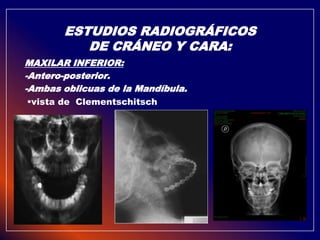 Anatomia de cranio y cara con diagnostico en rx | PDF