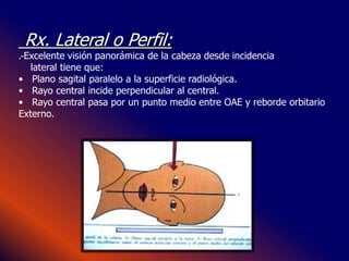 Anatomia de cranio y cara con diagnostico en rx | PDF