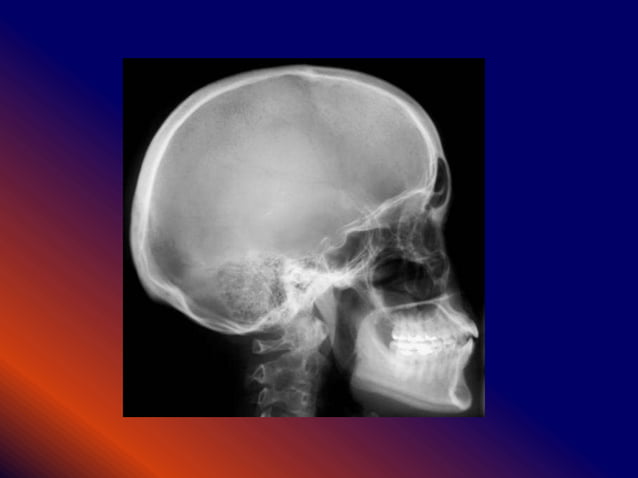 Anatomia de cranio y cara con diagnostico en rx | PDF