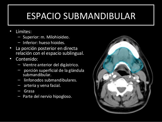 ANATOMIA DEL CUELLO EN TC