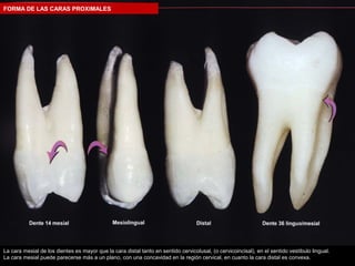 Anatomia de dentes permanentes | PPT
