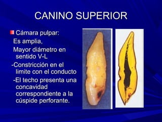 Anatomia De Dientes Anteriores 31 | PPT