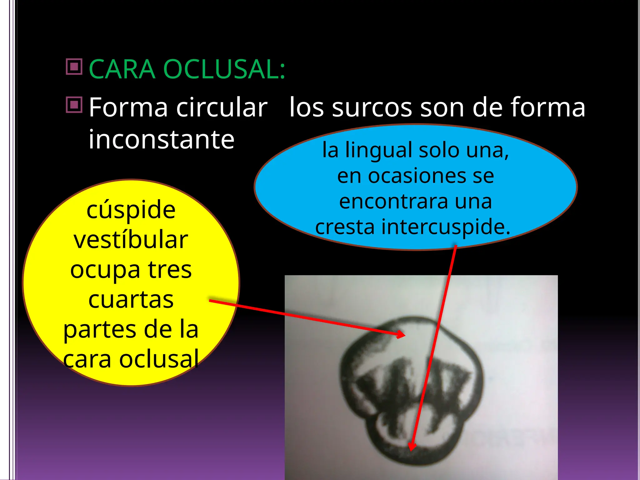 ANATOMIA DE DIENTES POSTERIORES SUPERIORES.pptx