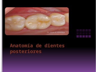 ANATOMIA DE DIENTES POSTERIORES SUPERIORES.pptx