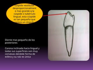 ANATOMIA DE DIENTES POSTERIORES SUPERIORES.pptx