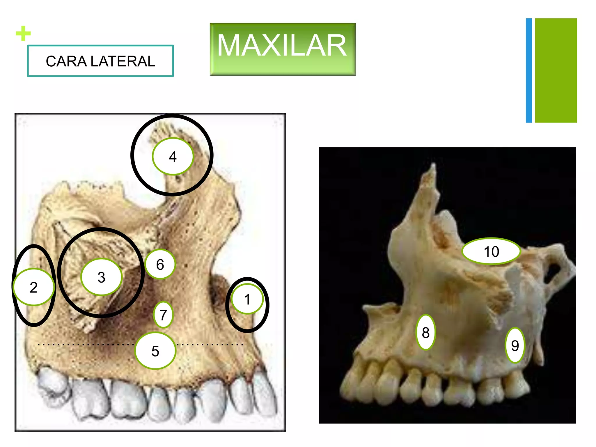 Modificaciones de la anatomia maxilar y mandibular por perdida de ...