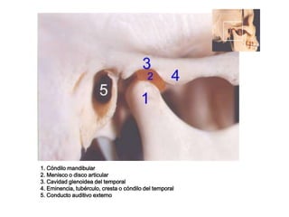 ANATOMIA DE LA ARTICULACION TEMPOROMANDIBULAR | PPTX