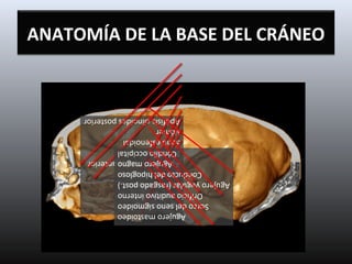 Anatomia de la base del craneo | PPT