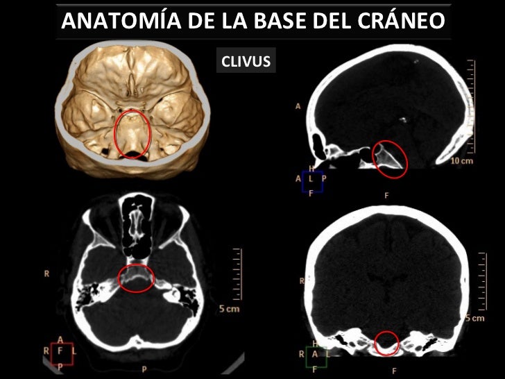 Anatomia de la base del craneo
