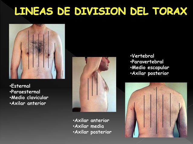 ANATOMIA DE LA PARED TORACICA JUAN.pptx