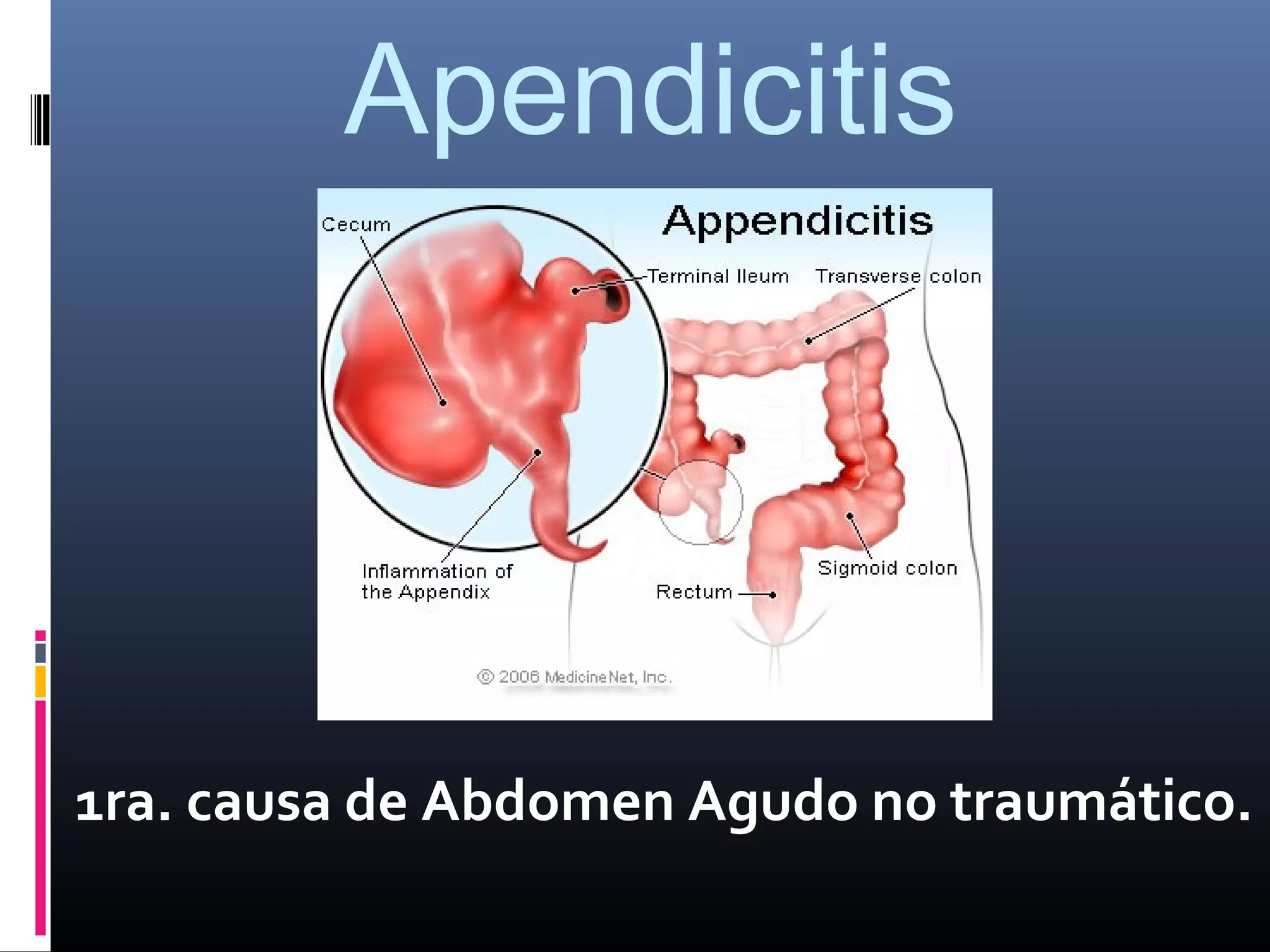 Anatomia del apendice | PPT