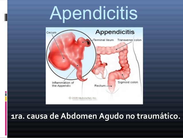 Anatomia del apendice