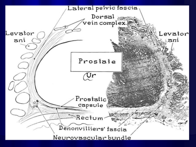 ANATOMIA DE LA PROSTATA.ppt