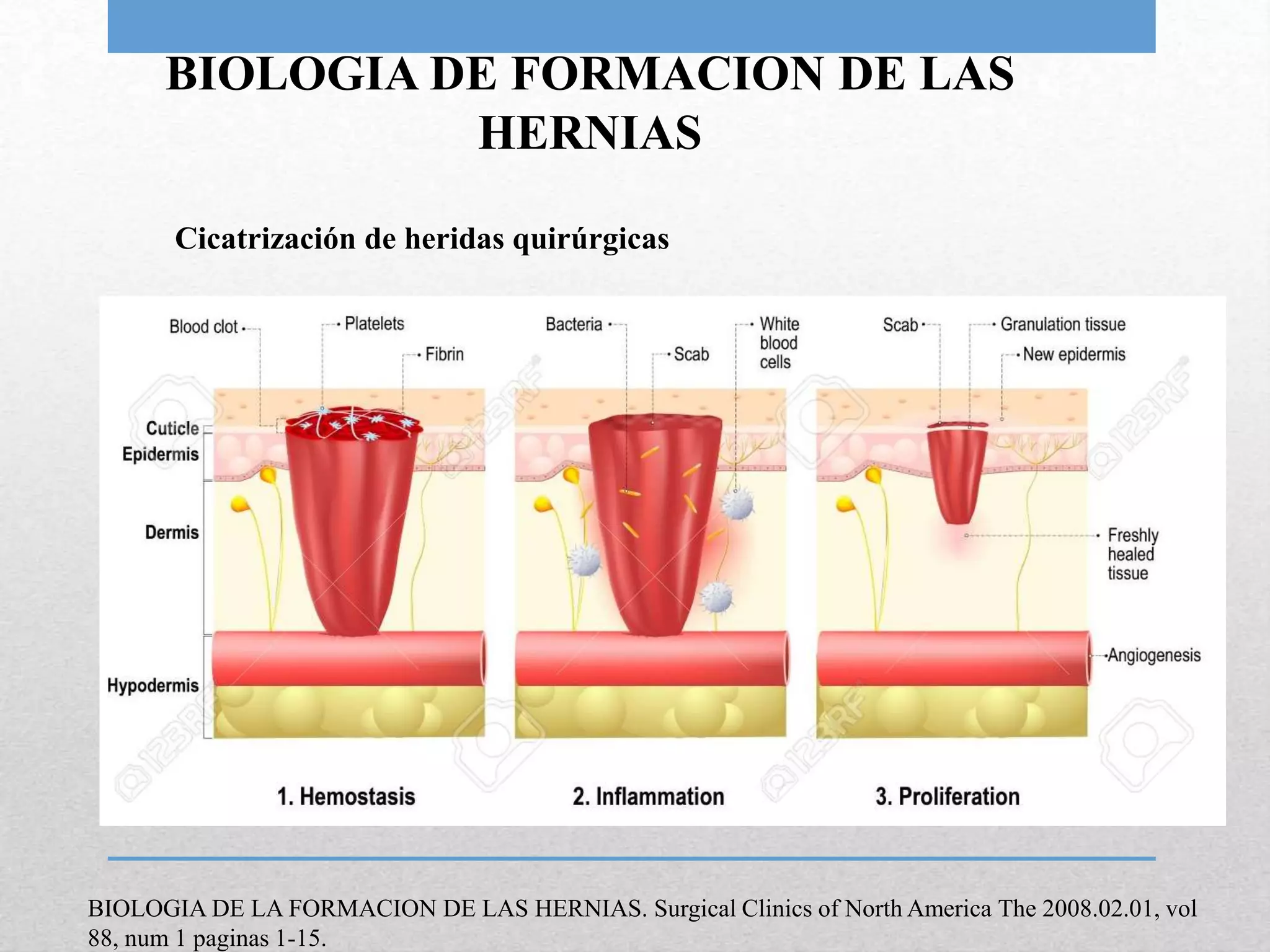 ANATOMIA DE LA REGION INGUINAL .ppt