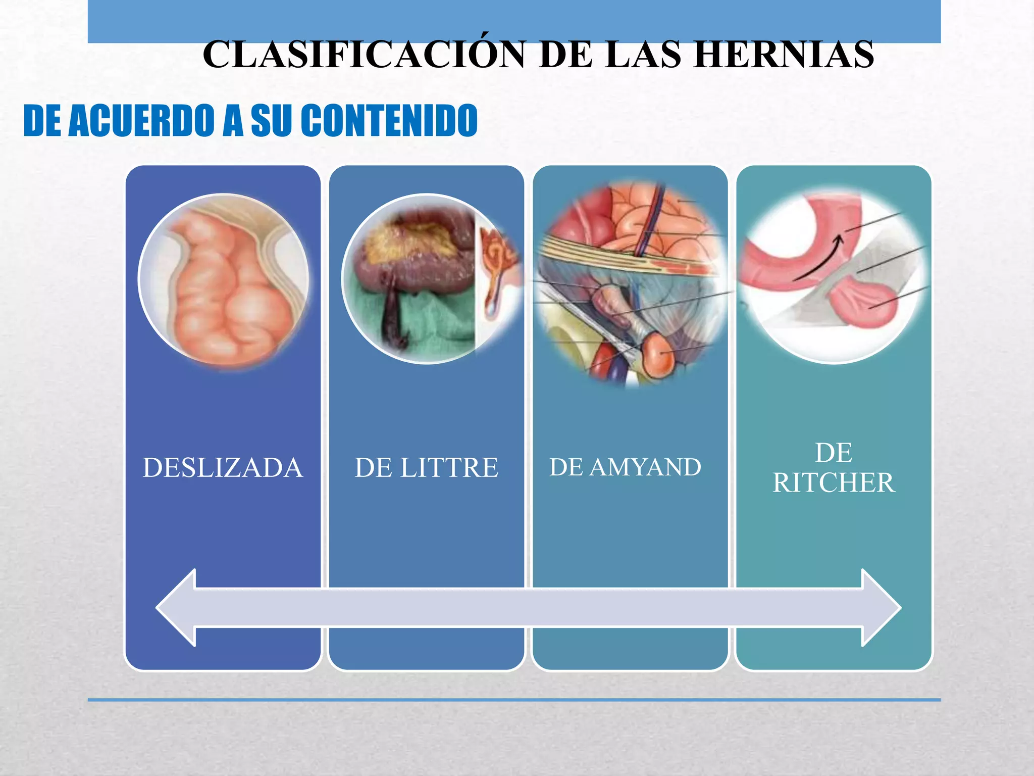 ANATOMIA DE LA REGION INGUINAL .ppt
